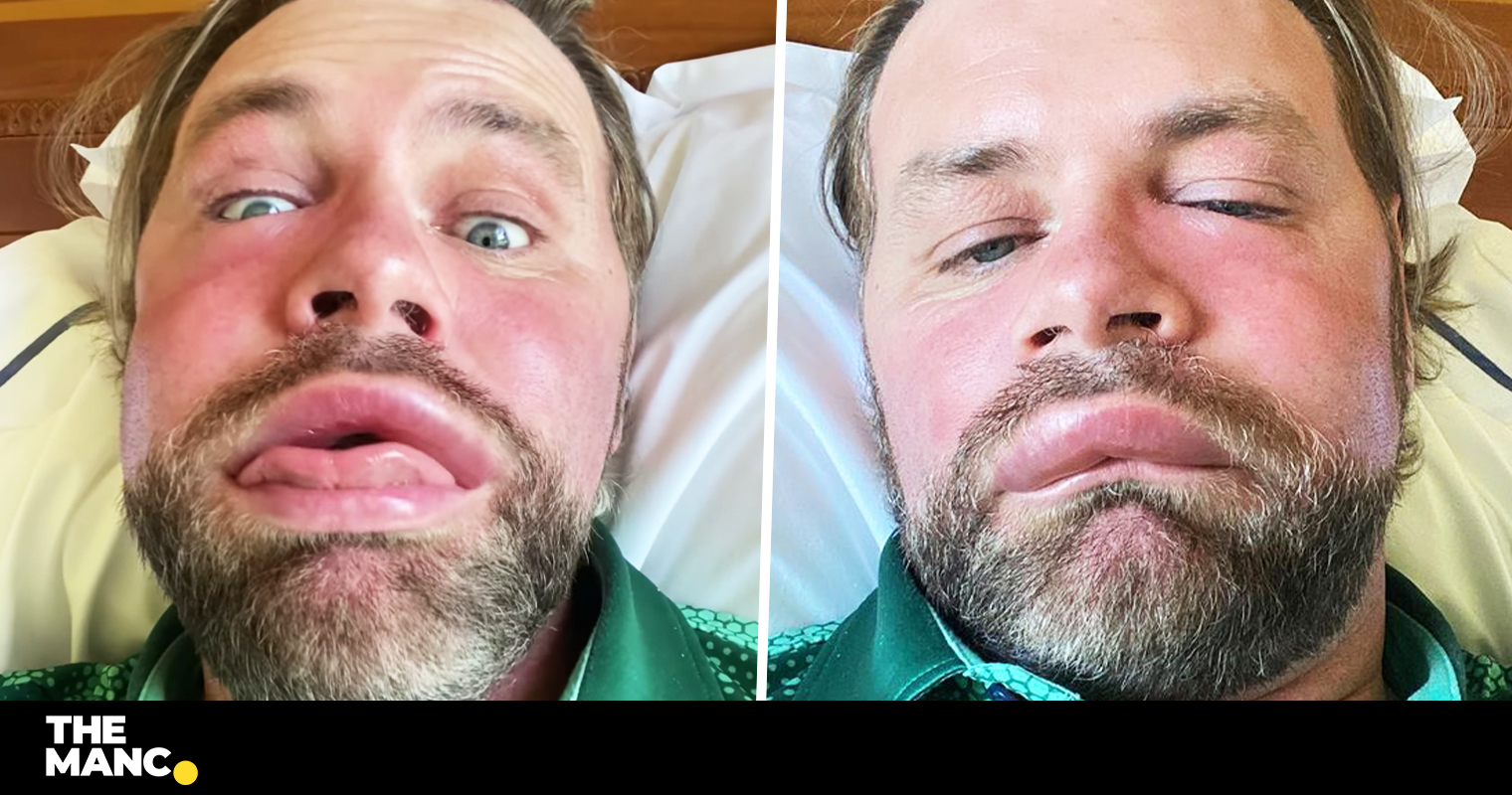 Brian McFadden's 'free Botox and fillers' face has shocked fans