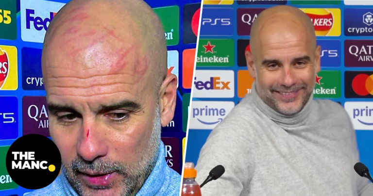 Concern as Pep appears with cuts on his face after Man City blow 3-goal ...